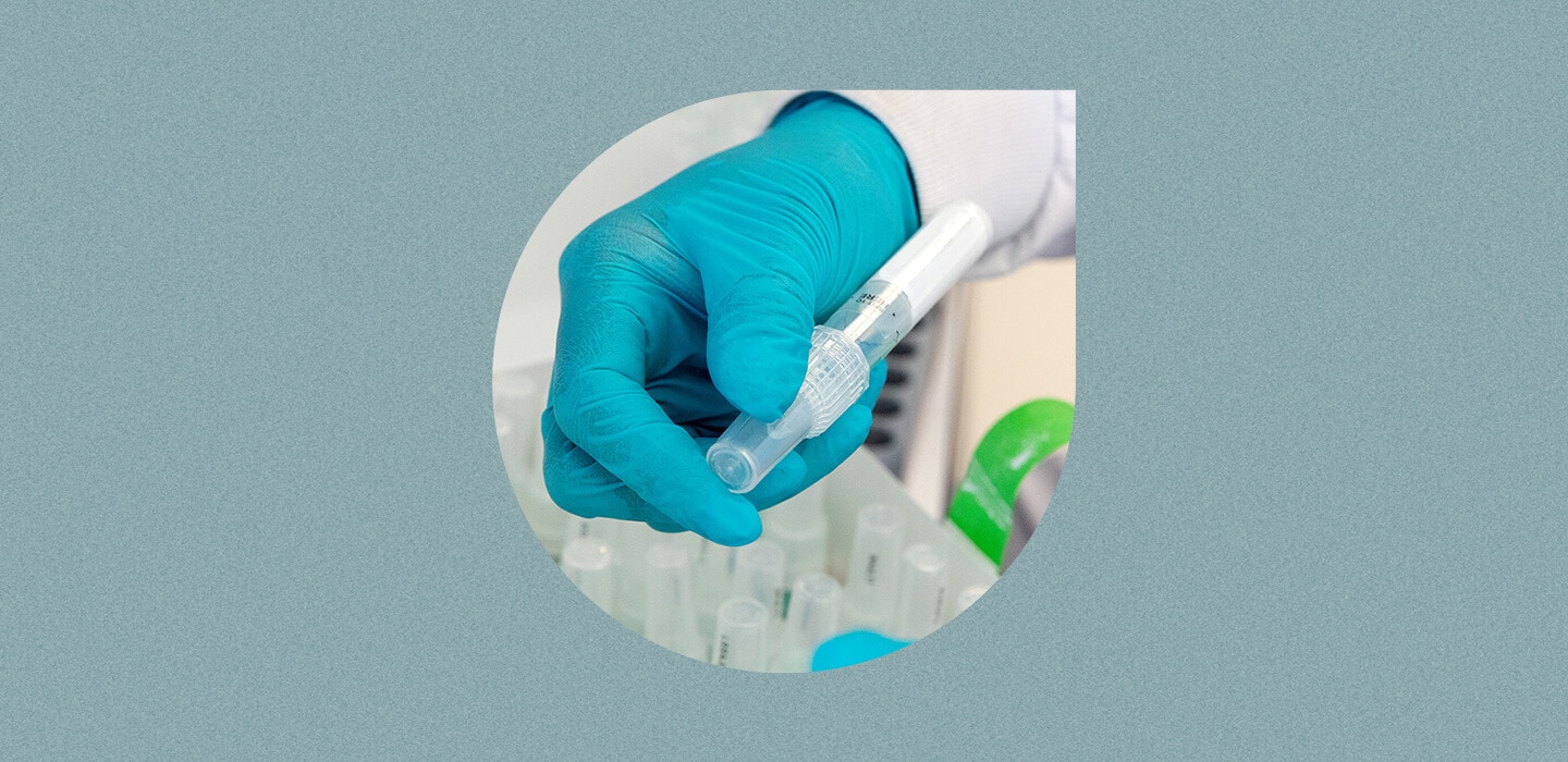 5 Things You Need to Know About Taking an AncestryDNA® Test